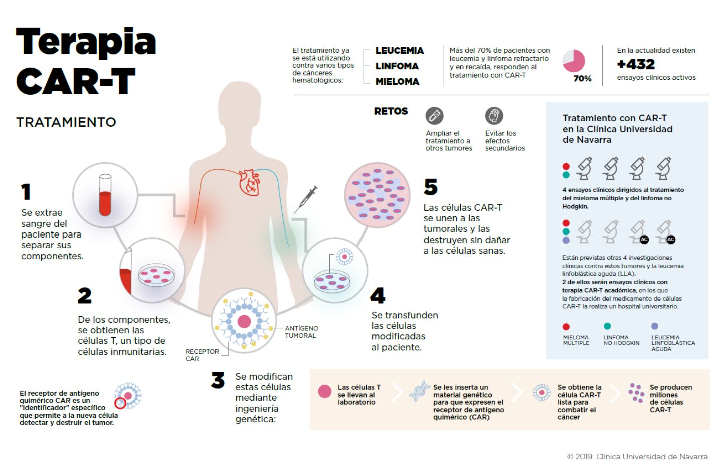 Terapia con células CAR-T. CART Cells. Clínica Universidad de Navarra