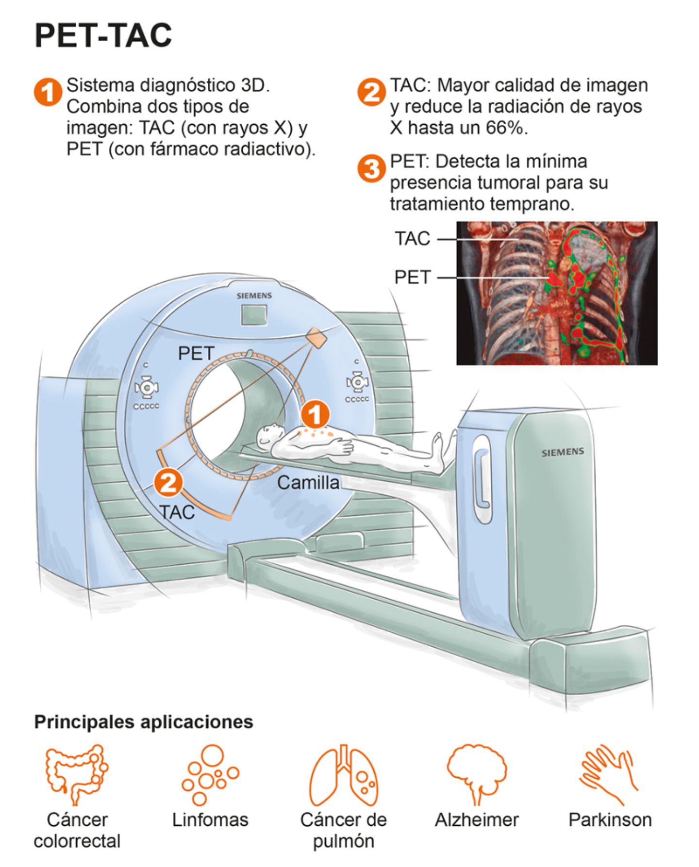 En el piso Oscuro Persona australiana pet tac precauciones despues Dolor Médico artículo