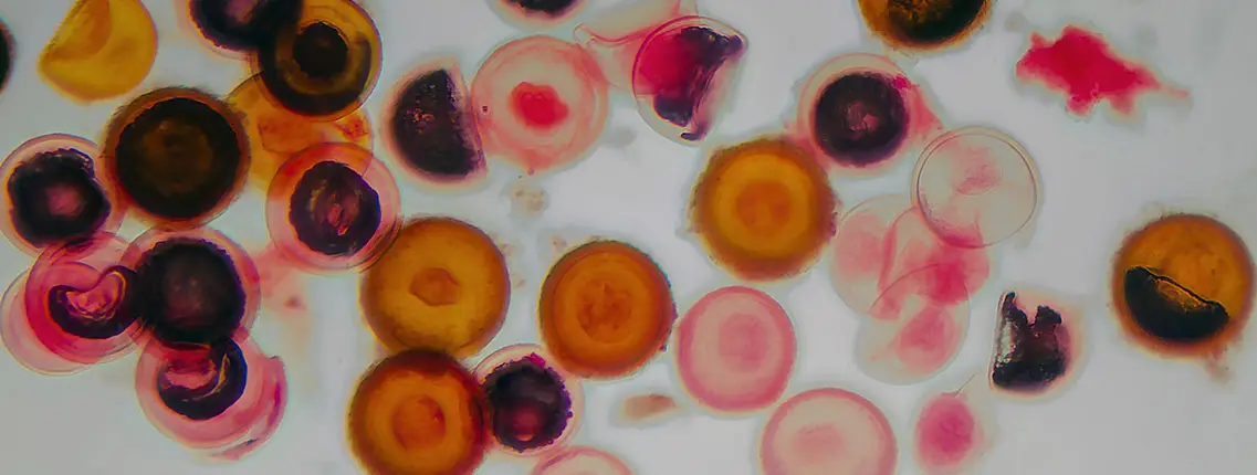 Tenias En Humanos Xray